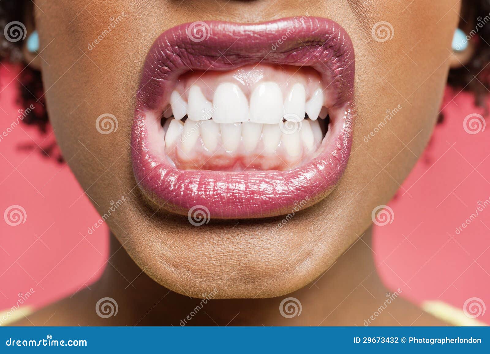 Cropped Image of Woman Clenching Teeth Stock Photo - Image of female ...