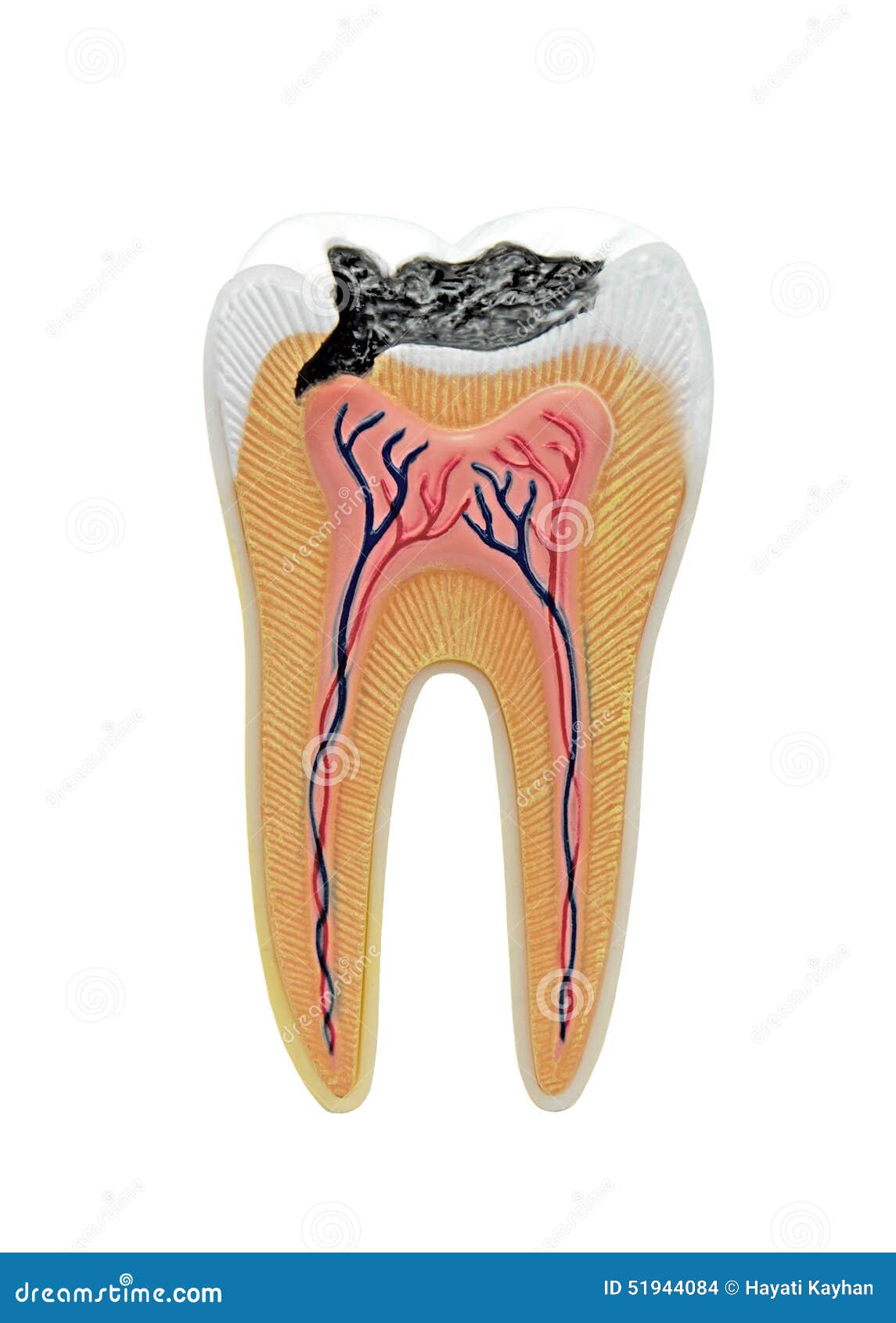 Cross Section of a Anatomical Tooth Model Stock Photo - Image of care ...