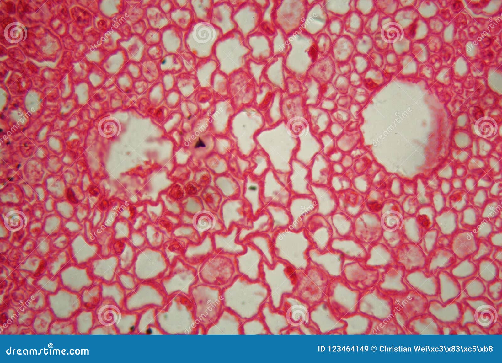 Zea Root Tip, Maize Plant Root, Longitudinal Section, Light Micrograph ...