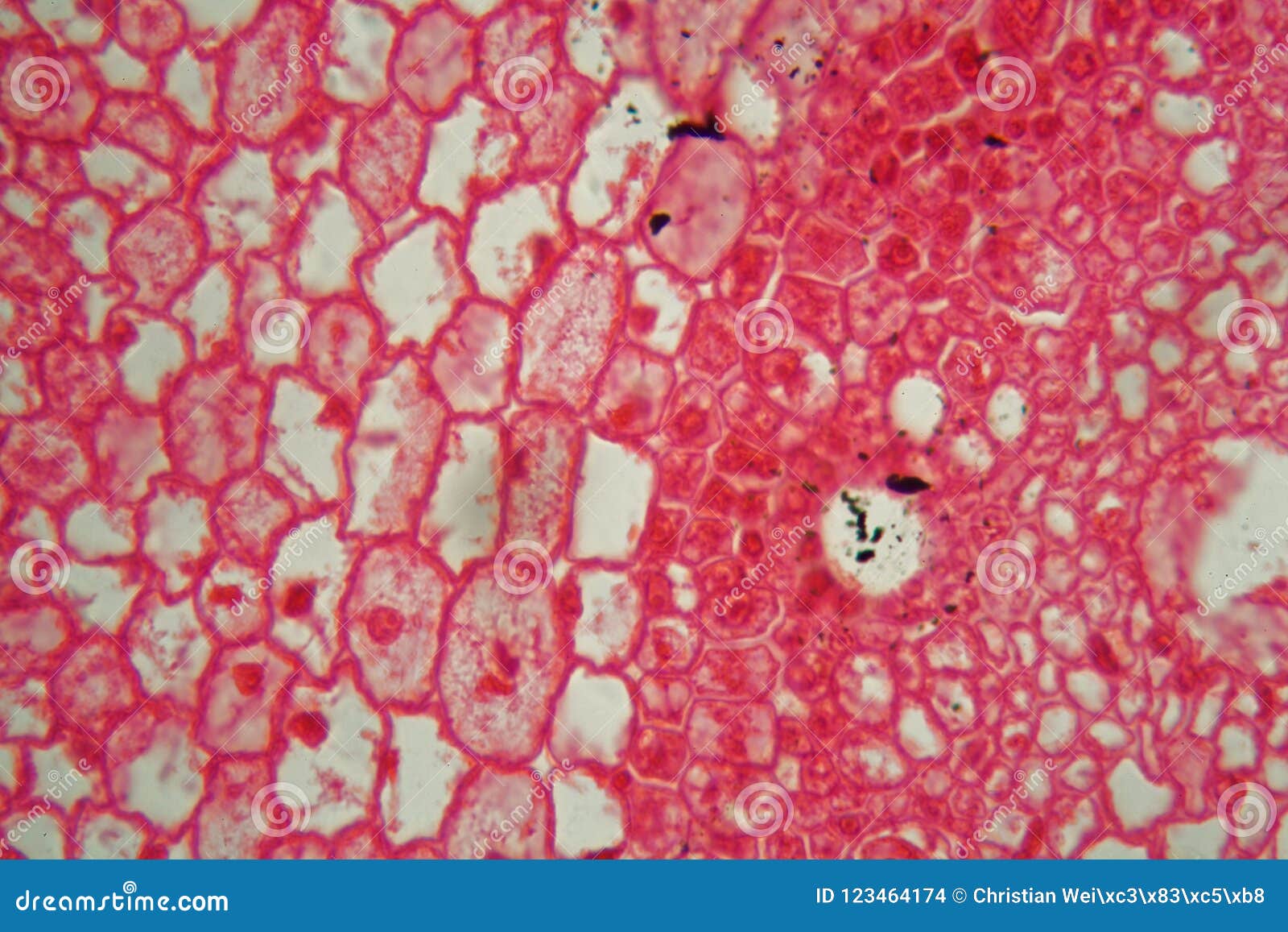 Zea Root Tip, Maize Plant Root, Longitudinal Section, Light Micrograph ...