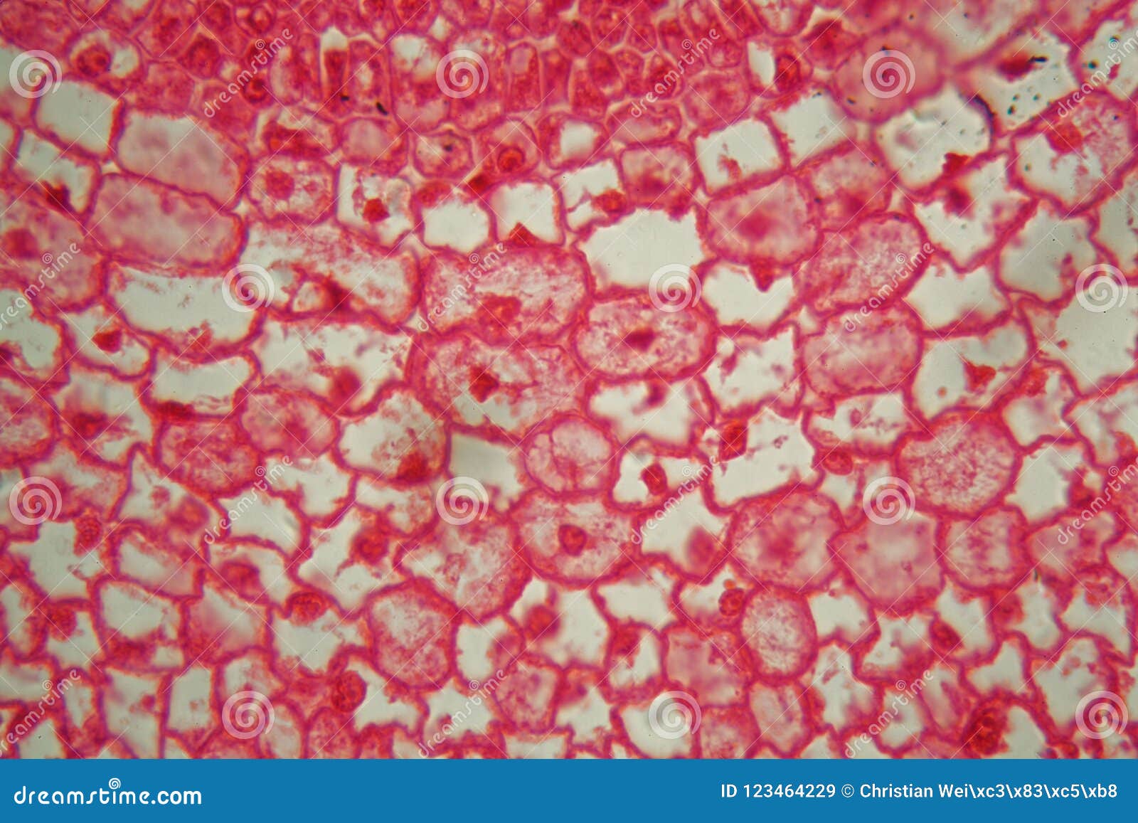 Zea Root Tip, Maize Plant Root, Longitudinal Section, Light Micrograph ...
