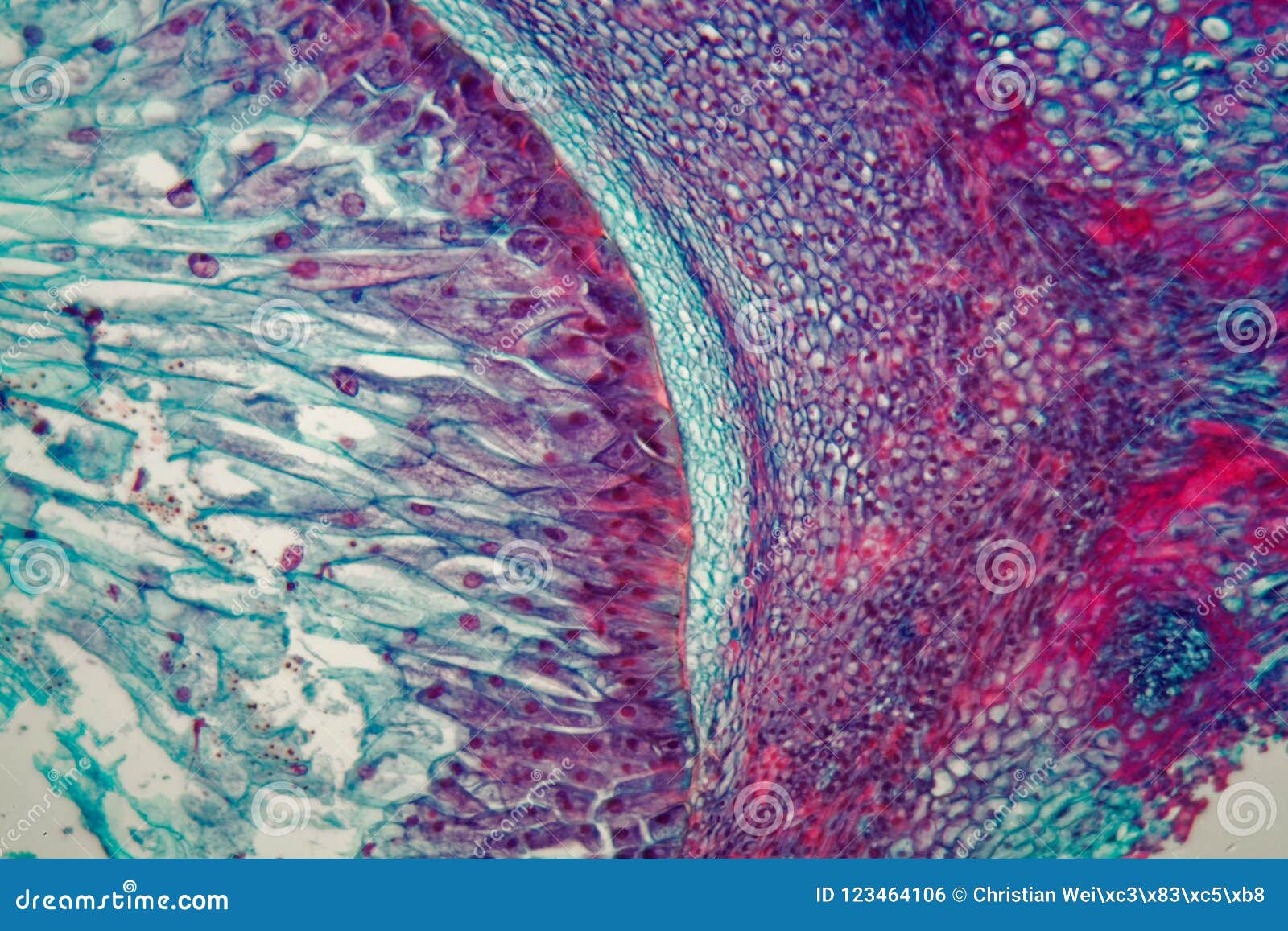 Angiosperm Cross Section Tissue