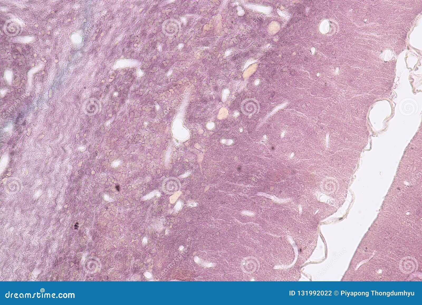 Cross Section of the Cerebellum and Nerve Human Under the Microscope ...