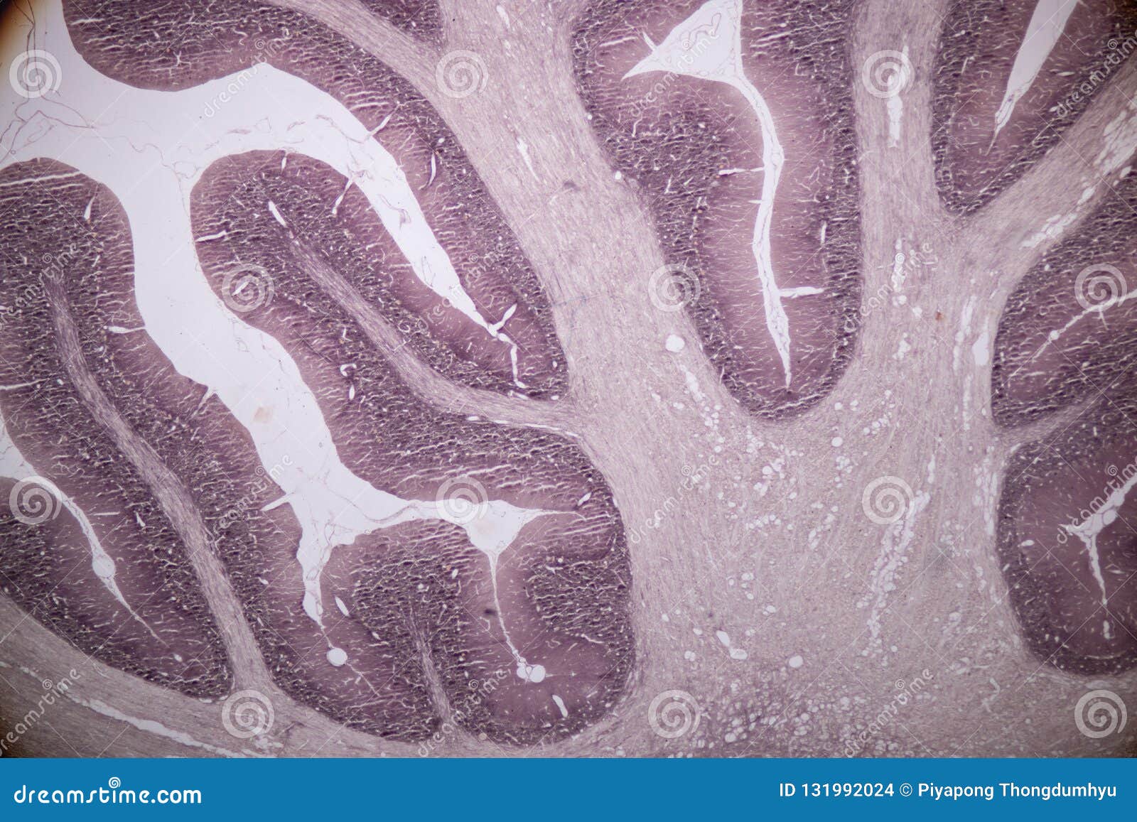Cross Section of the Cerebellum and Nerve Human Under the Microscope ...