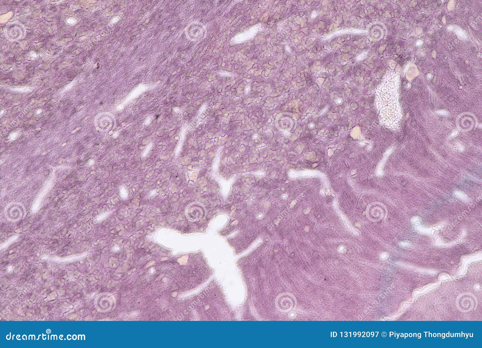 Cross Section of the Cerebellum and Nerve Human Under the Microscope ...