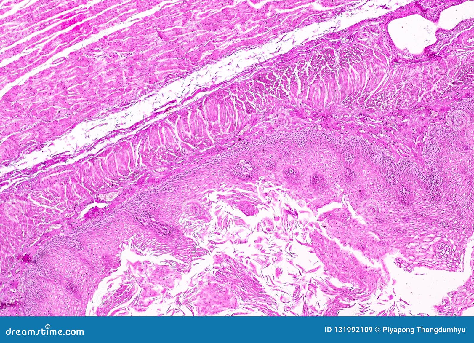 Cross Section of the Cerebellum and Nerve Human Under the Microscope ...