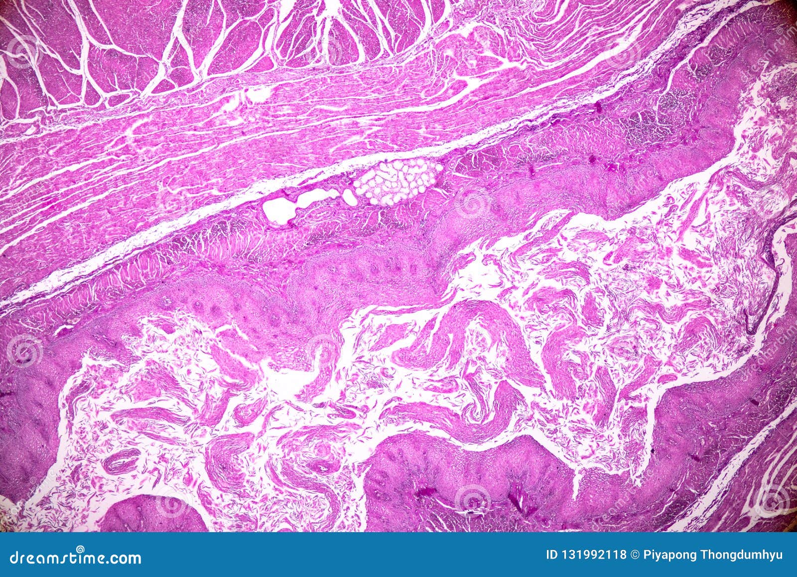 Cross Section of the Cerebellum and Nerve Human Under the Microscope ...
