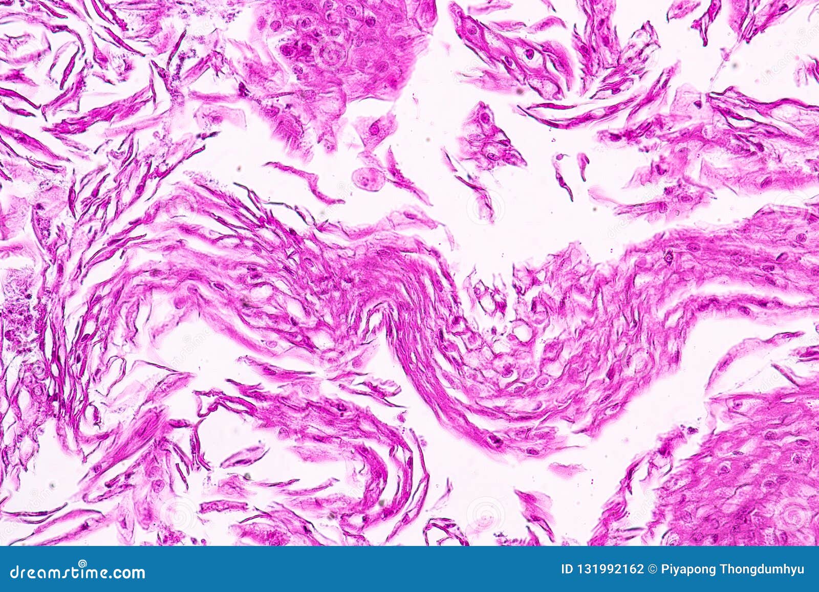 Cross Section of the Cerebellum and Nerve Human Under the Microscope ...