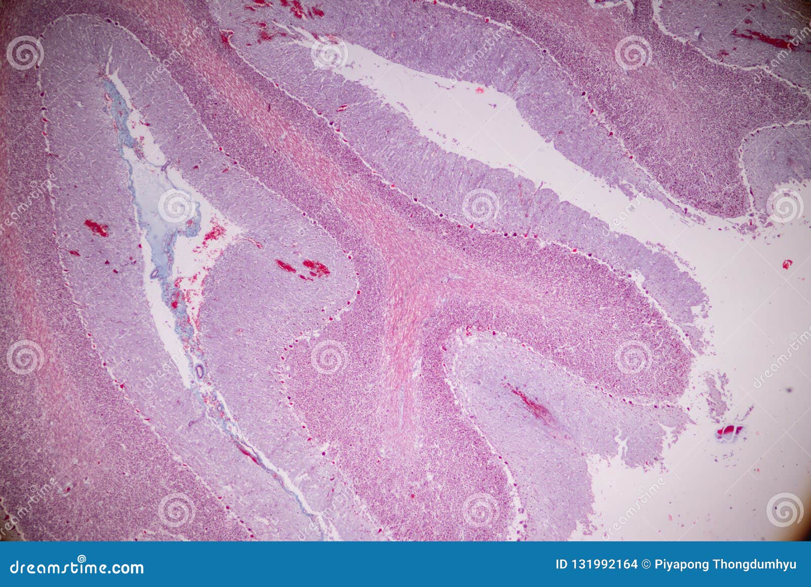 Cross Section of the Cerebellum and Nerve Human Under the Microscope ...