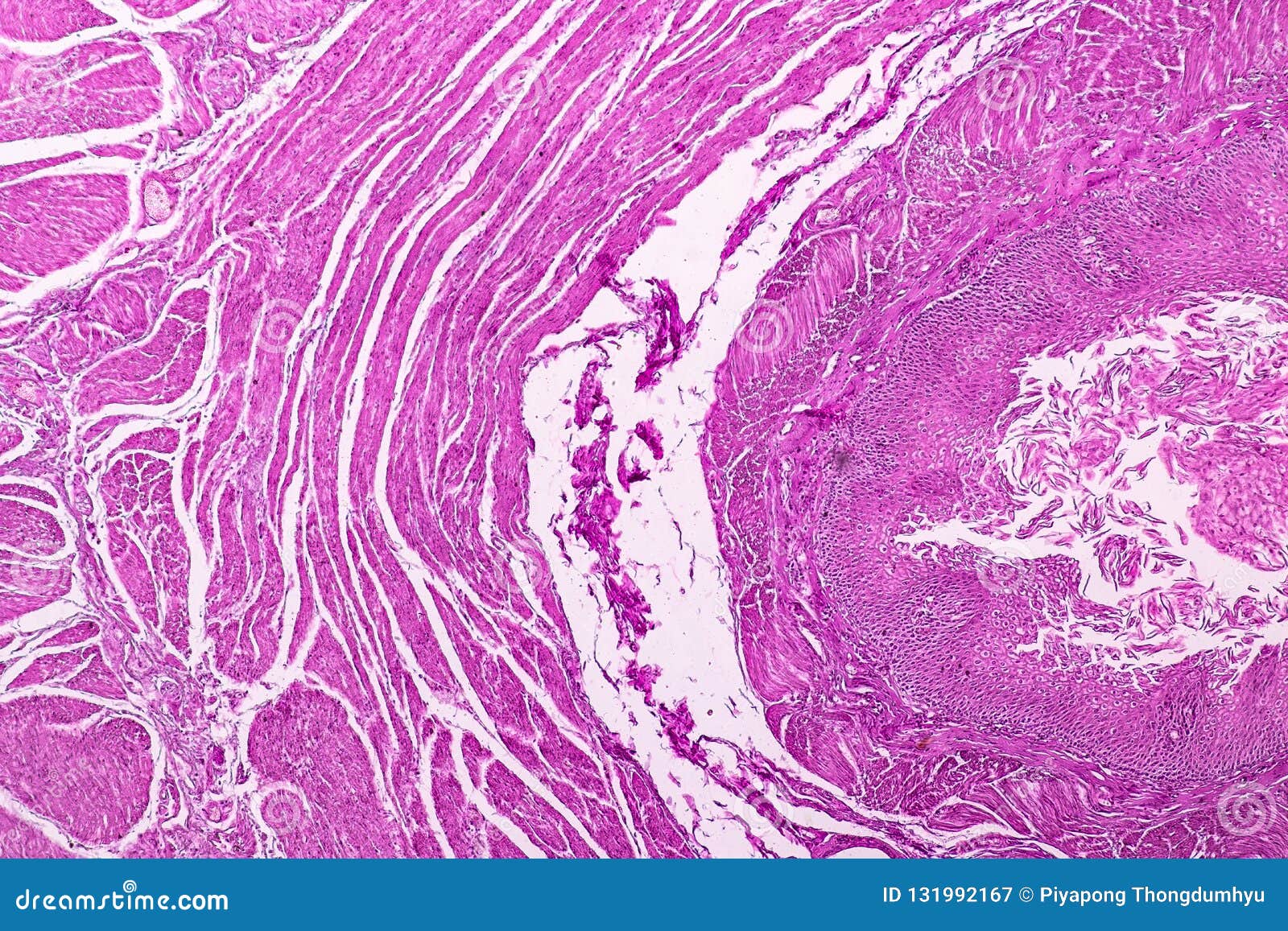 Cross Section of the Cerebellum and Nerve Human Under the Microscope ...