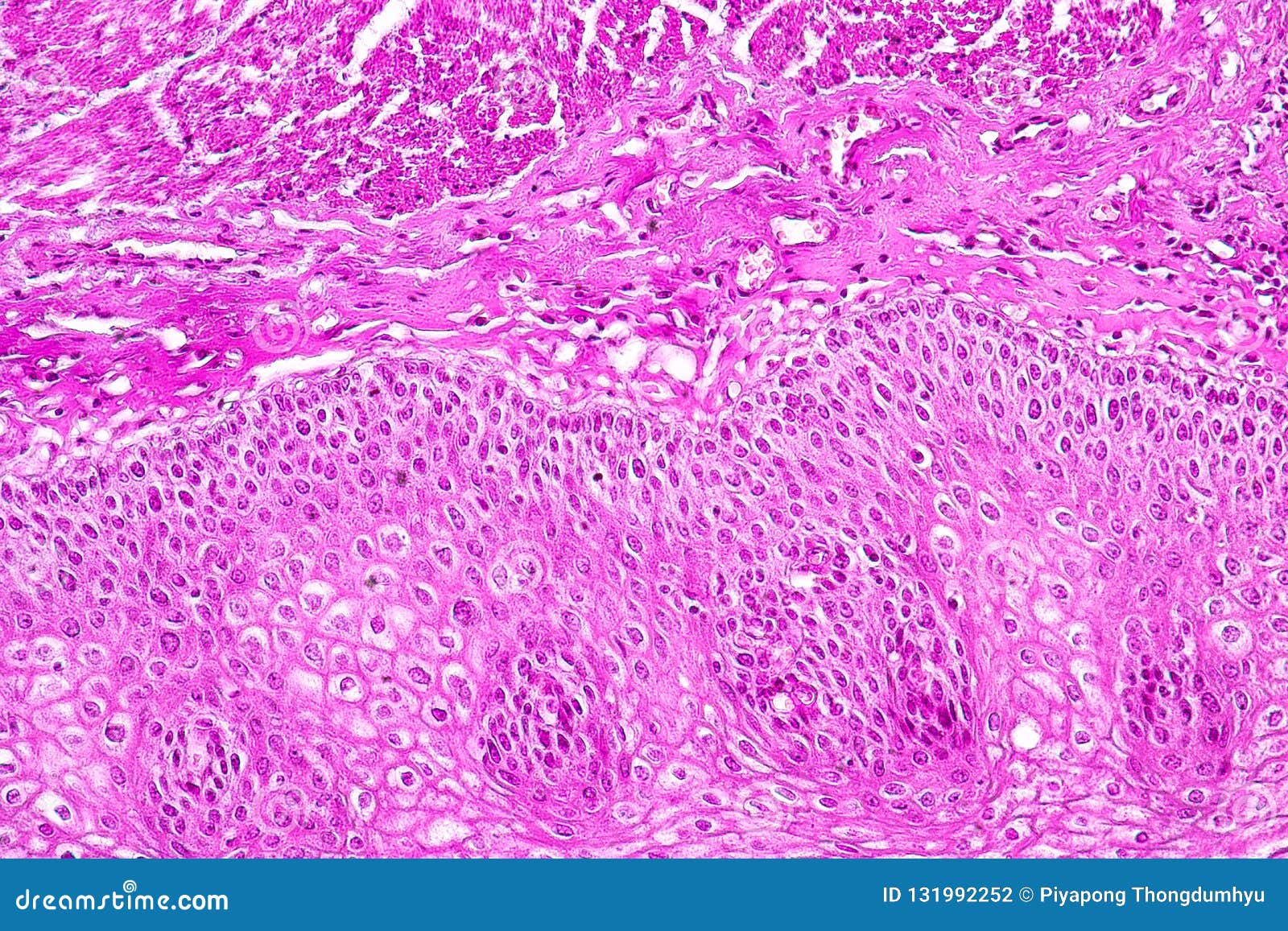 Cross Section of the Cerebellum and Nerve Human Under the Microscope ...