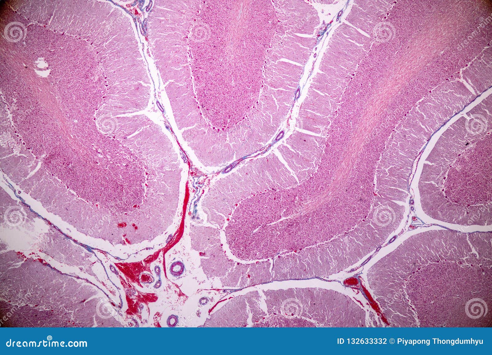 Cross Section of the Cerebellum and Nerve Human Under the Microscope ...