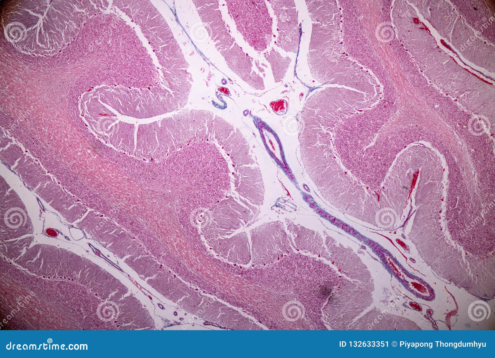 Cross Section of the Cerebellum and Nerve Human Under the Microscope ...