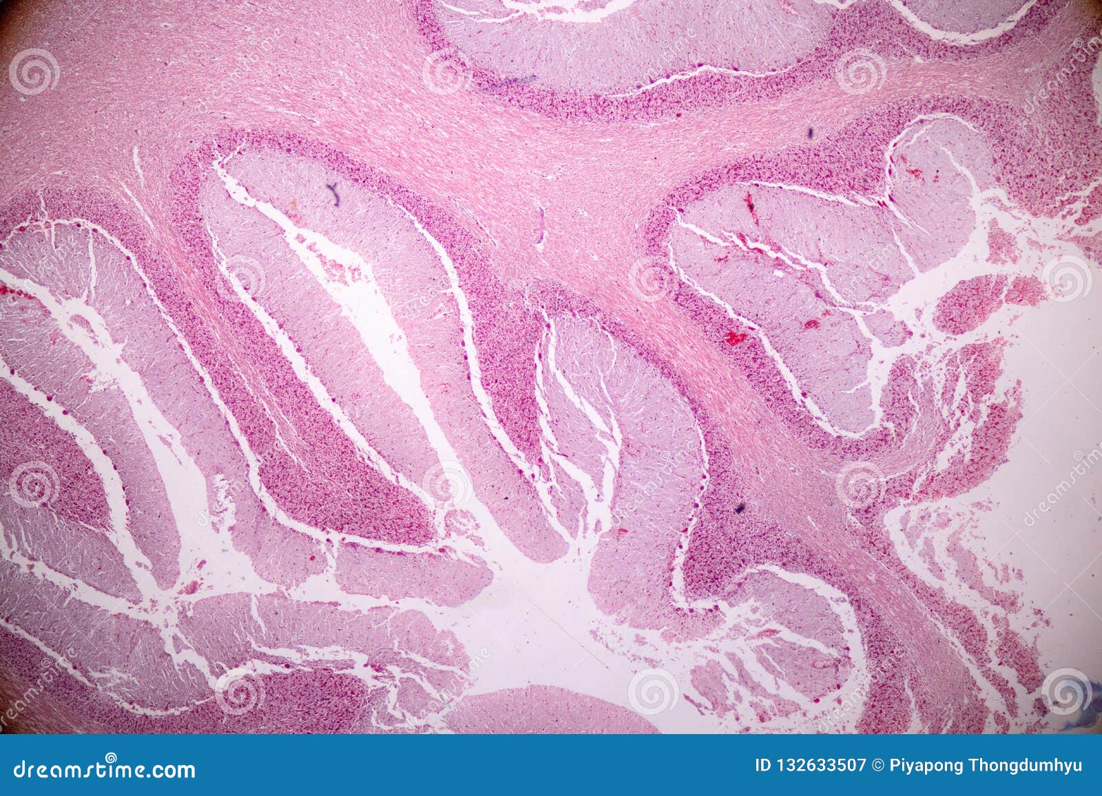 Cross Section of the Cerebellum and Nerve Human Under the Microscope ...