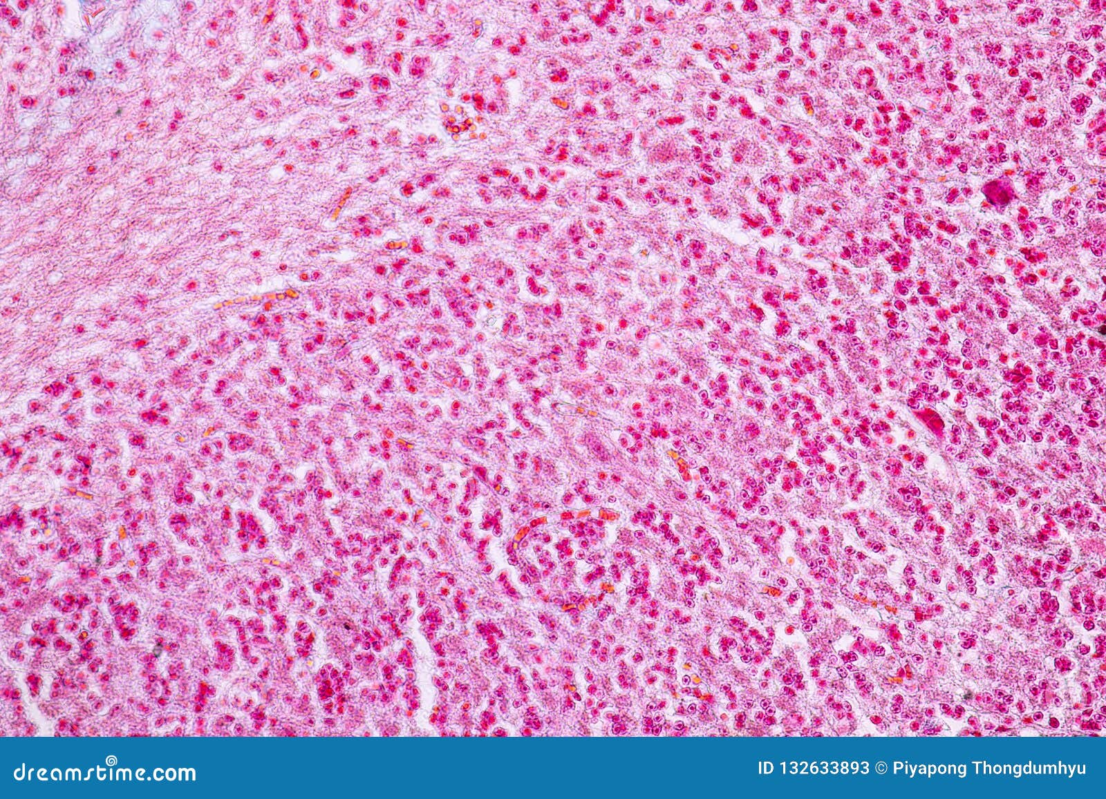 Cross Section of the Cerebellum and Nerve Human Under the Microscope ...