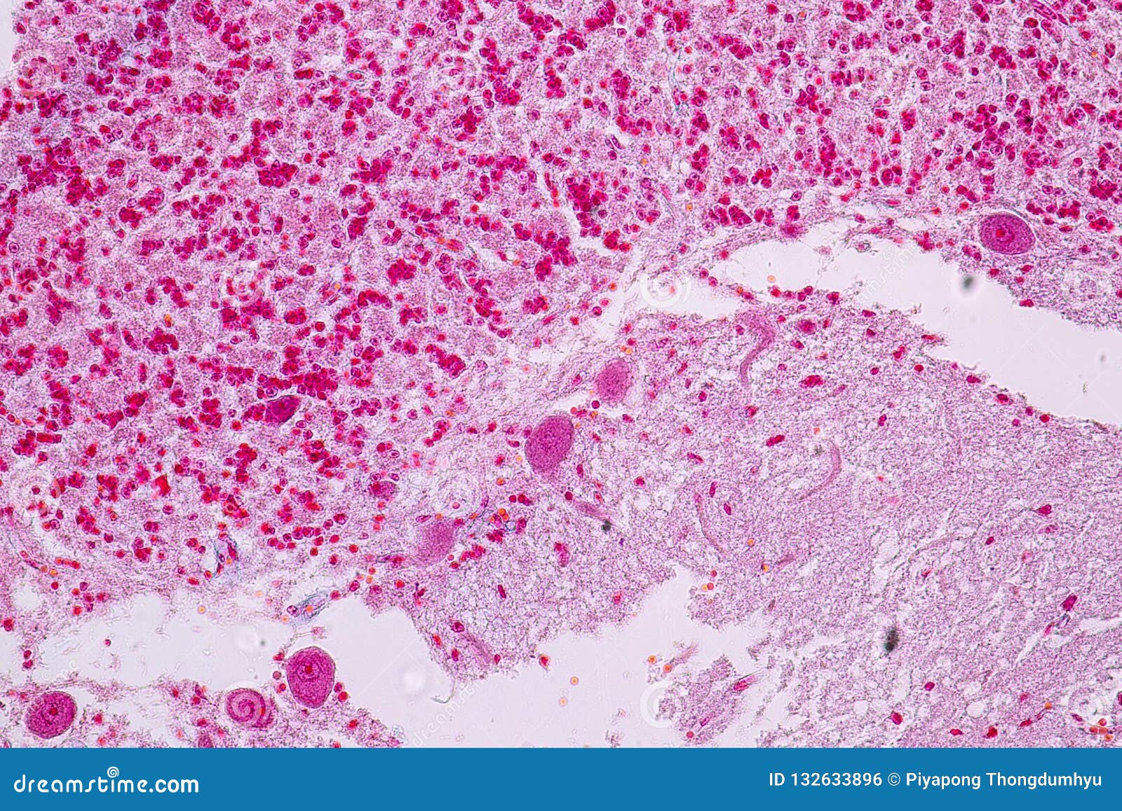 Cross Section of the Cerebellum and Nerve Human Under the Microscope ...