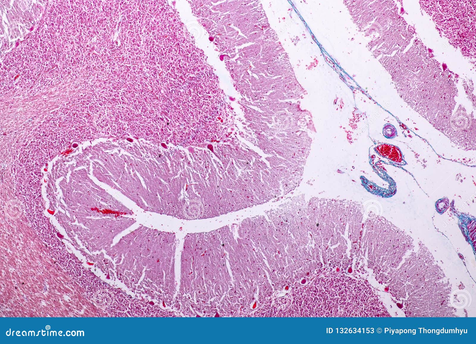 Cross Section of the Cerebellum and Nerve Human Under the Microscope ...