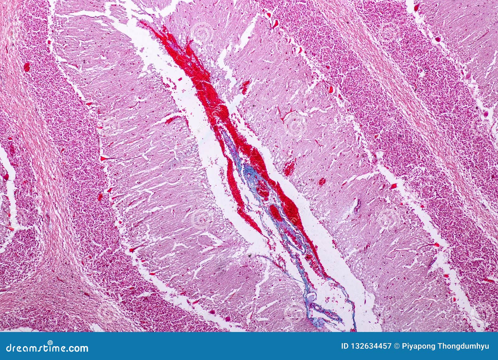 Cross Section of the Cerebellum and Nerve Human Under the Microscope ...
