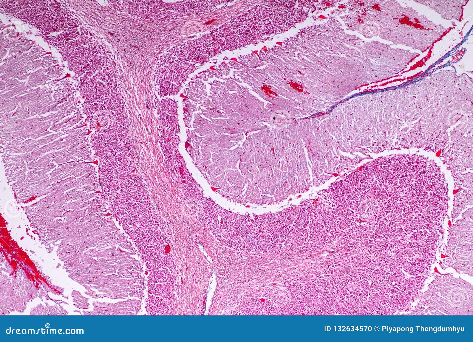 Cross Section of the Cerebellum and Nerve Human Under the Microscope ...