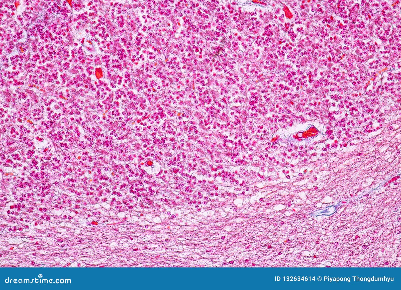 Cross Section of the Cerebellum and Nerve Human Under the Microscope ...
