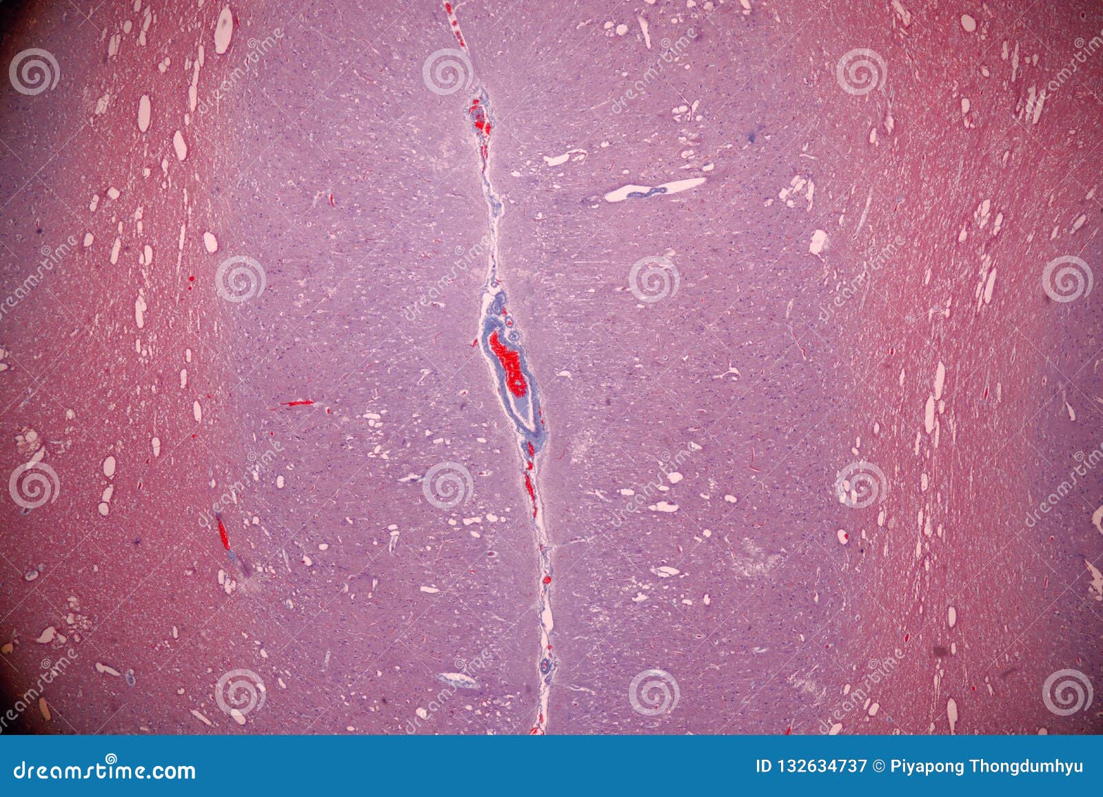 Cross Section of the Cerebellum and Nerve Human Under the Microscope ...