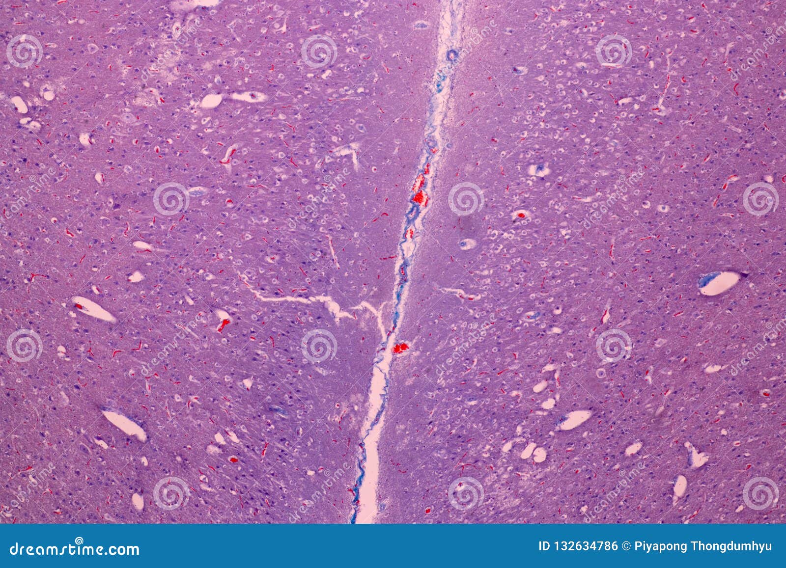 Cerebellum Cross Section Tissue Under The Light Microscope Royalty-Free ...