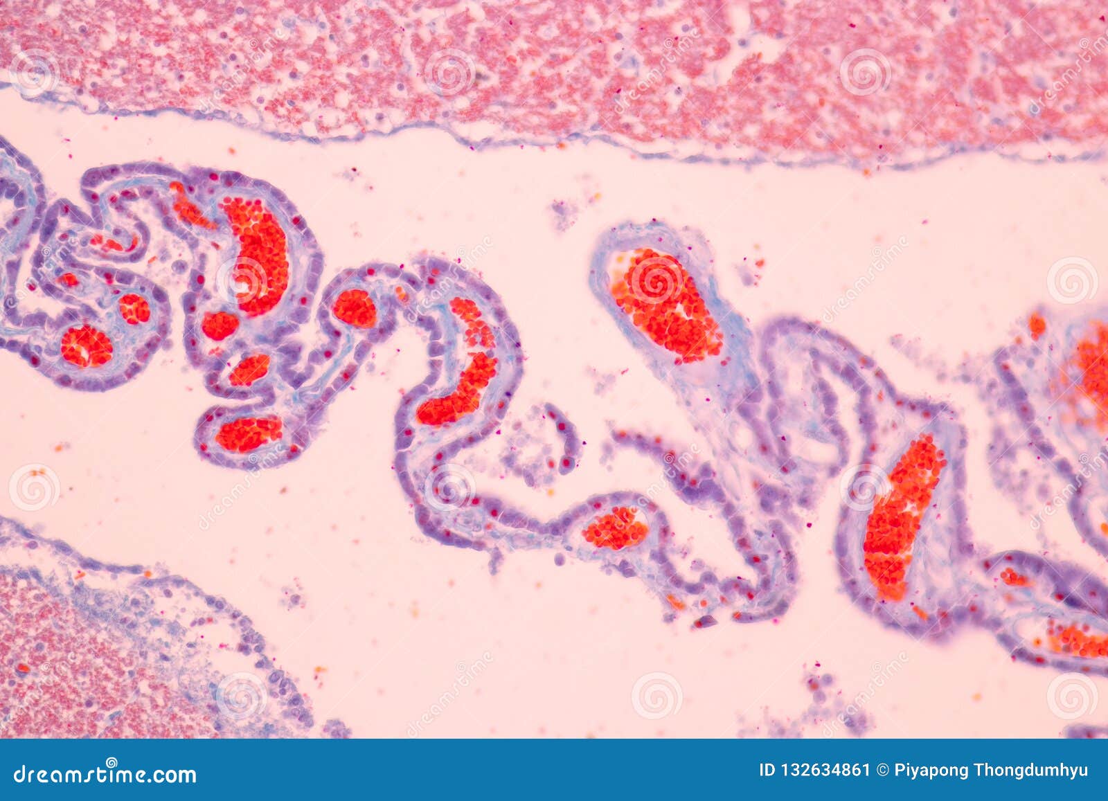 Cross Section of the Cerebellum and Nerve Human Under the Microscope ...