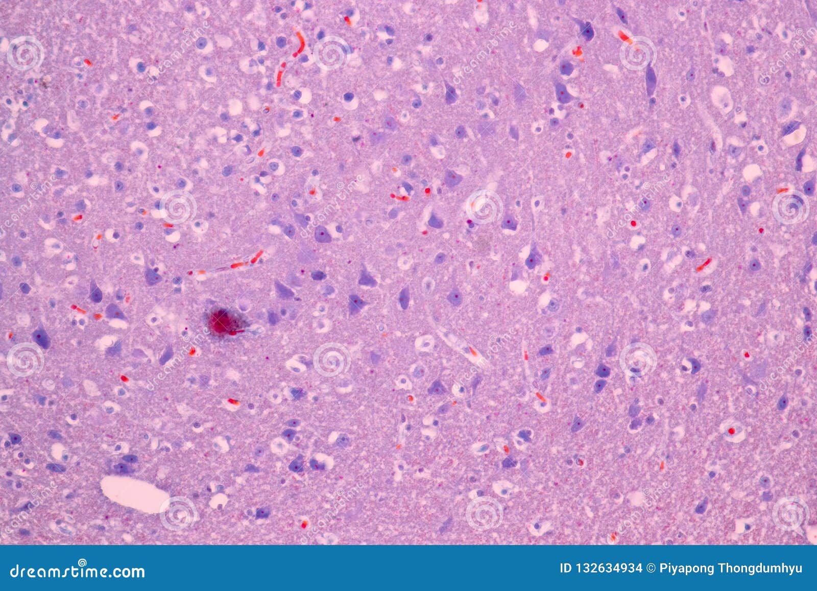 Cross Section of the Cerebellum and Nerve Human Under the Microscope ...