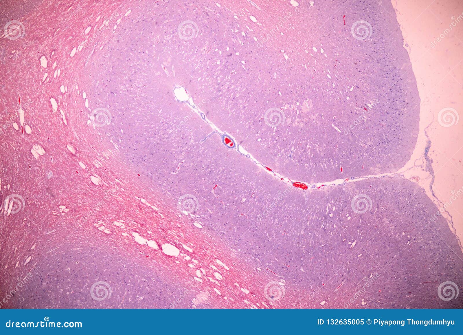 Cross Section of the Cerebellum and Nerve Human Under the Microscope ...