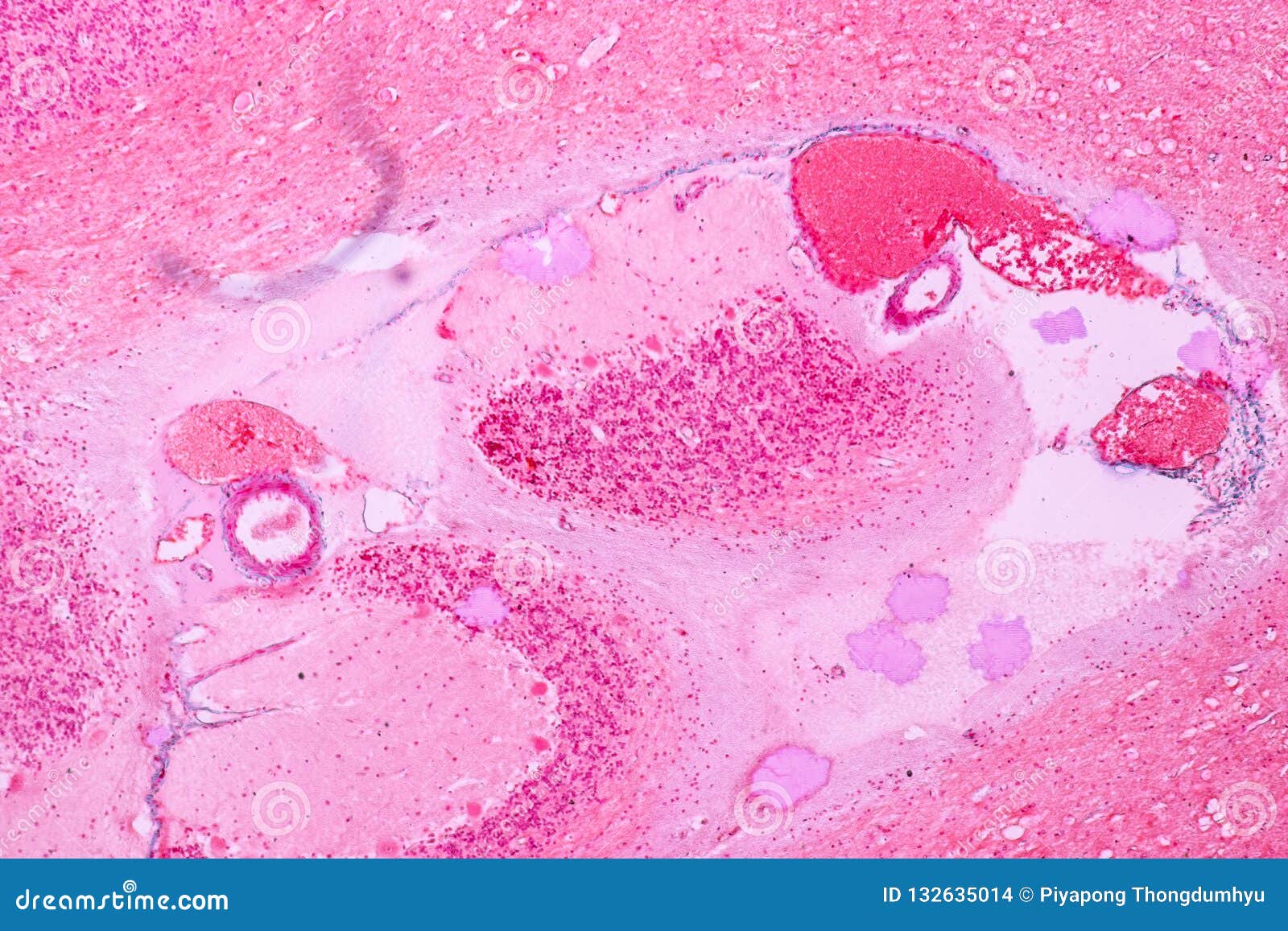 Cross Section of the Cerebellum and Nerve Human Under the Microscope ...