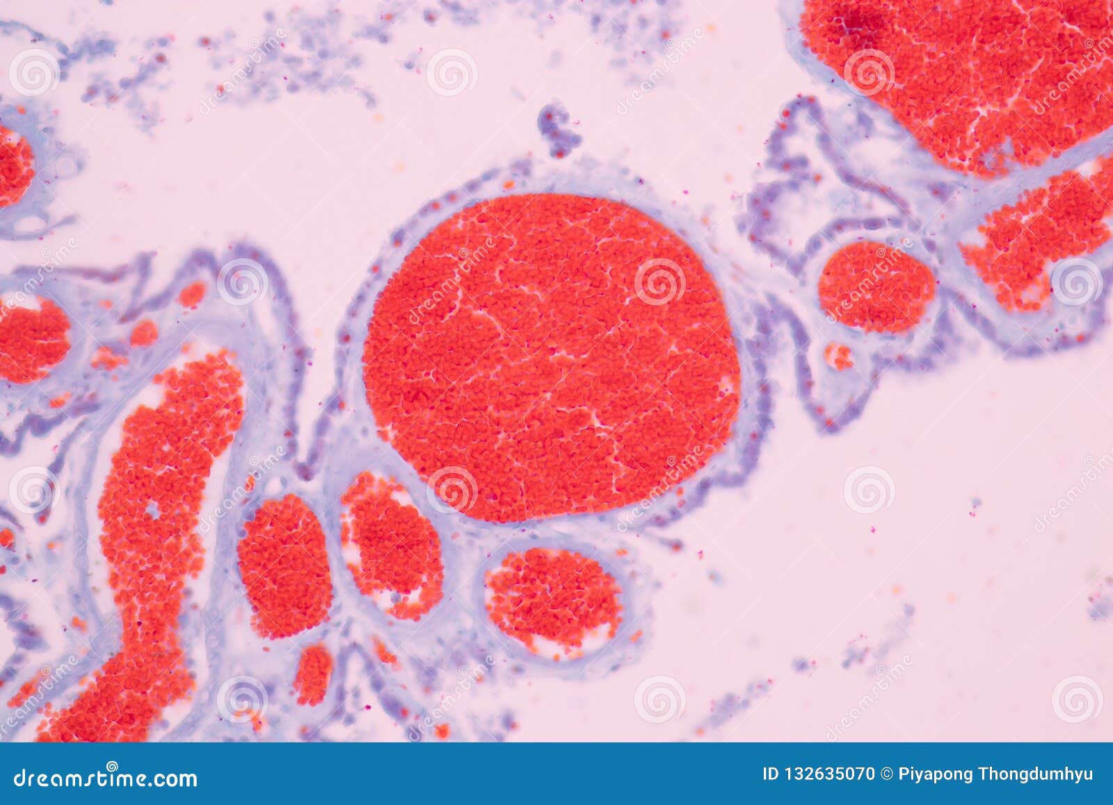 Cross Section of the Cerebellum and Nerve Human Under the Microscope ...
