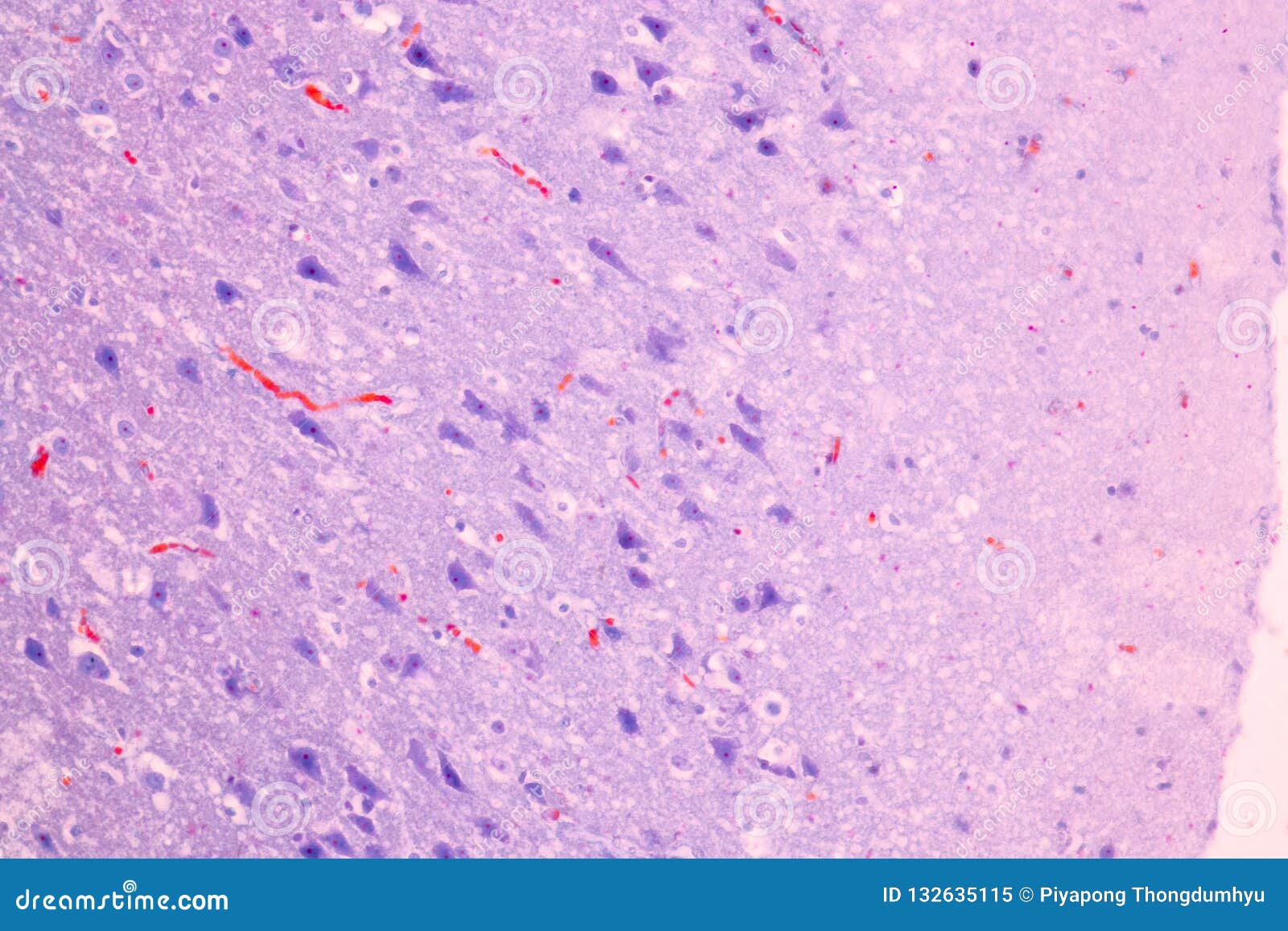 Cross Section of the Cerebellum and Nerve Human Under the Microscope ...