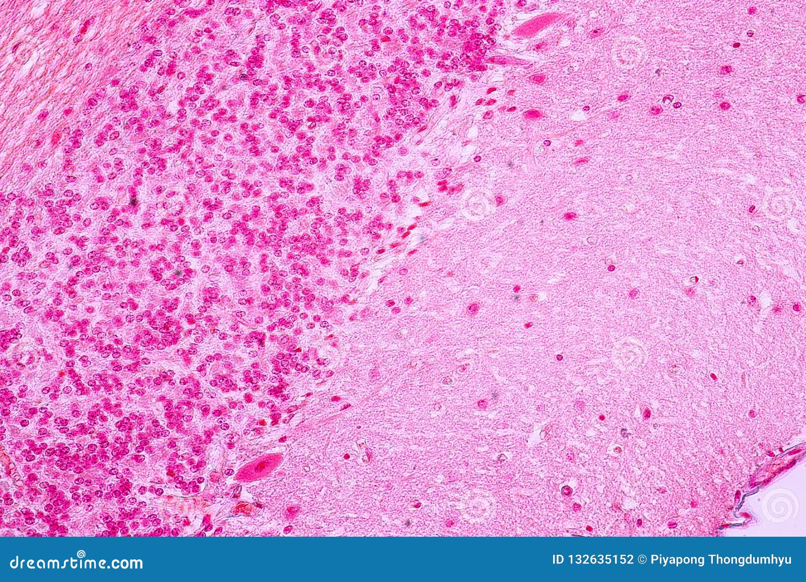 Cross Section of the Cerebellum and Nerve Human Under the Microscope ...