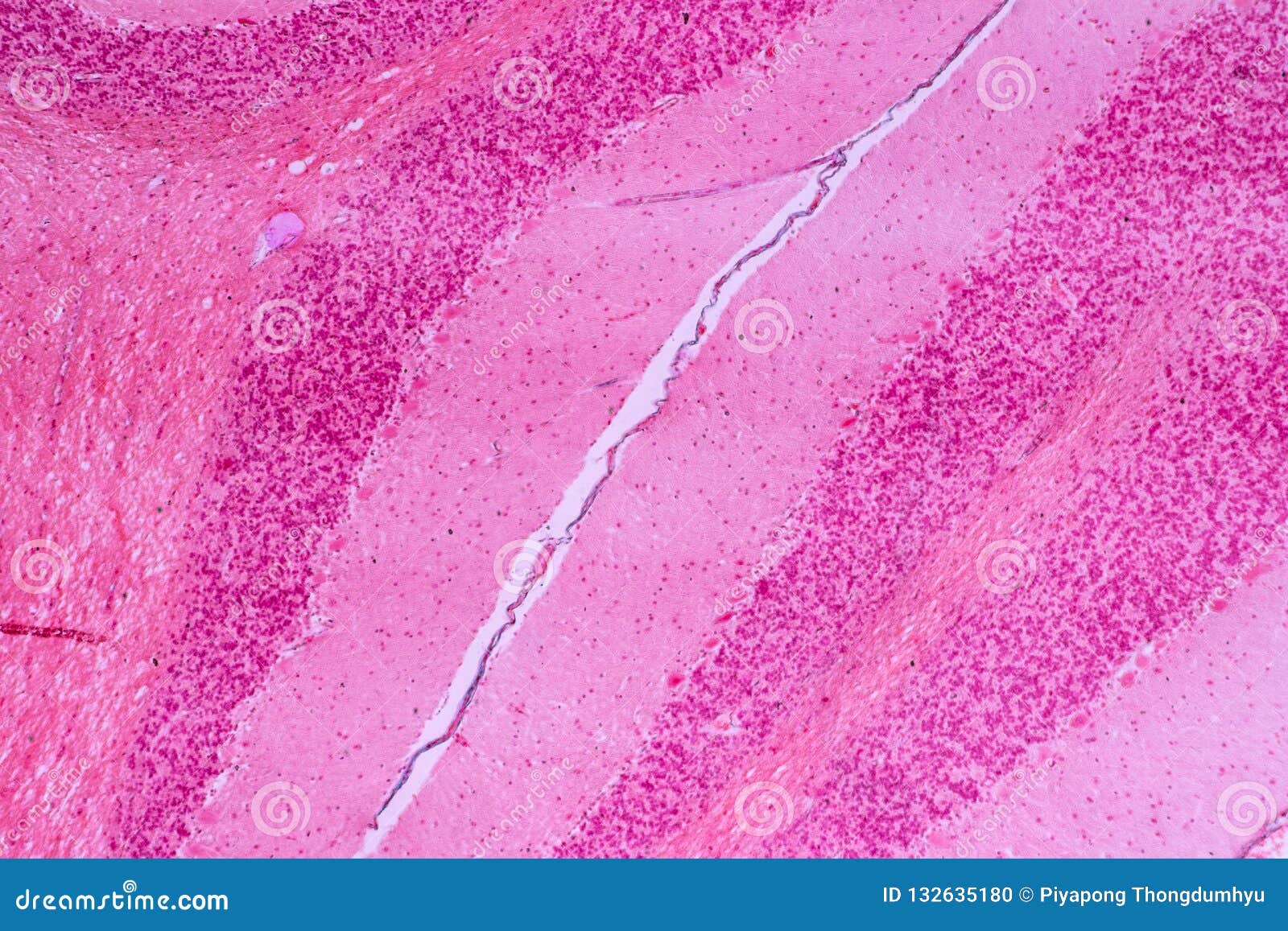 Cross Section of the Cerebellum and Nerve Human Under the Microscope ...