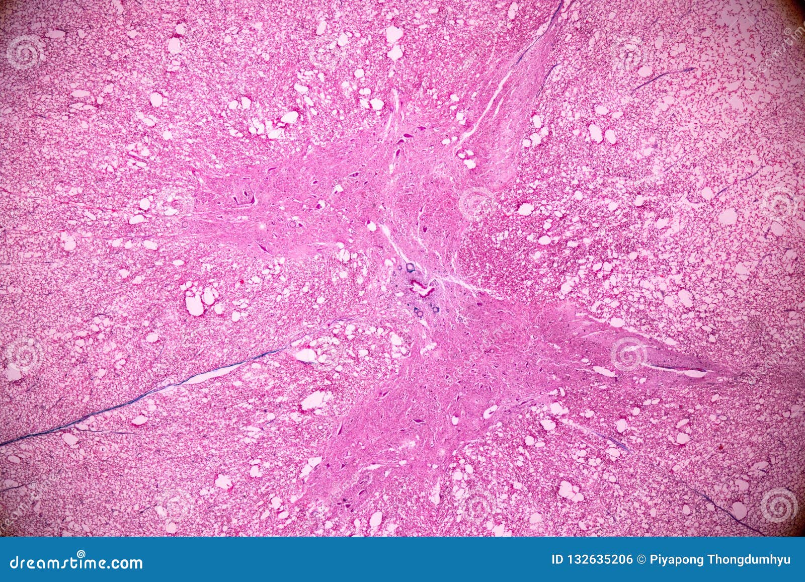 Cross Section of the Cerebellum and Nerve Human Under the Microscope ...