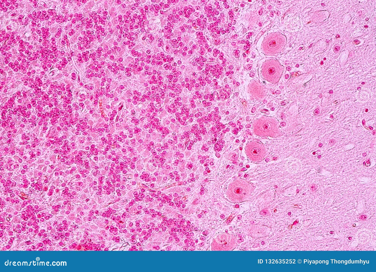 Cross Section of the Cerebellum and Nerve Human Under the Microscope ...