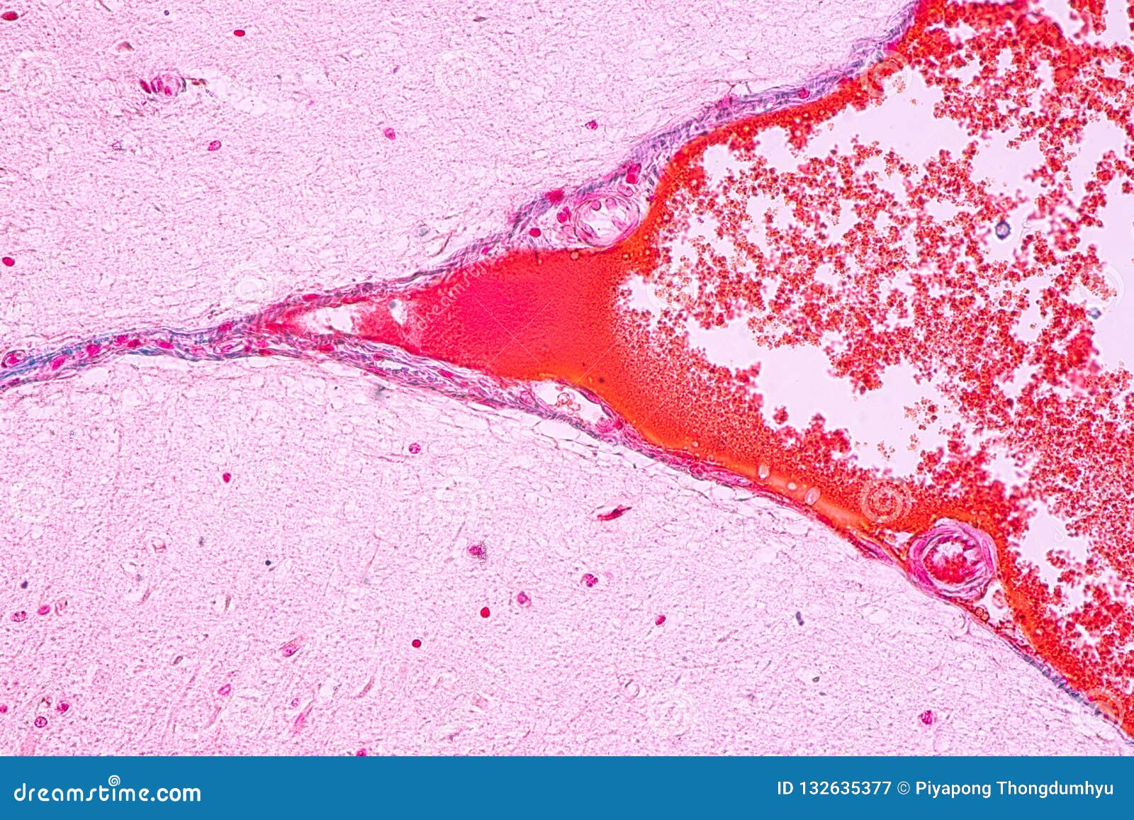 Cross Section of the Cerebellum and Nerve Human Under the Microscope ...