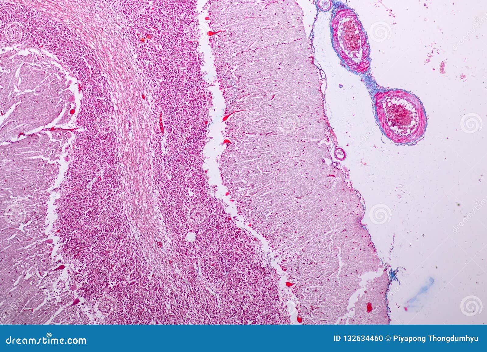 Cross Section of the Cerebellum and Nerve Human Under the Microscope ...