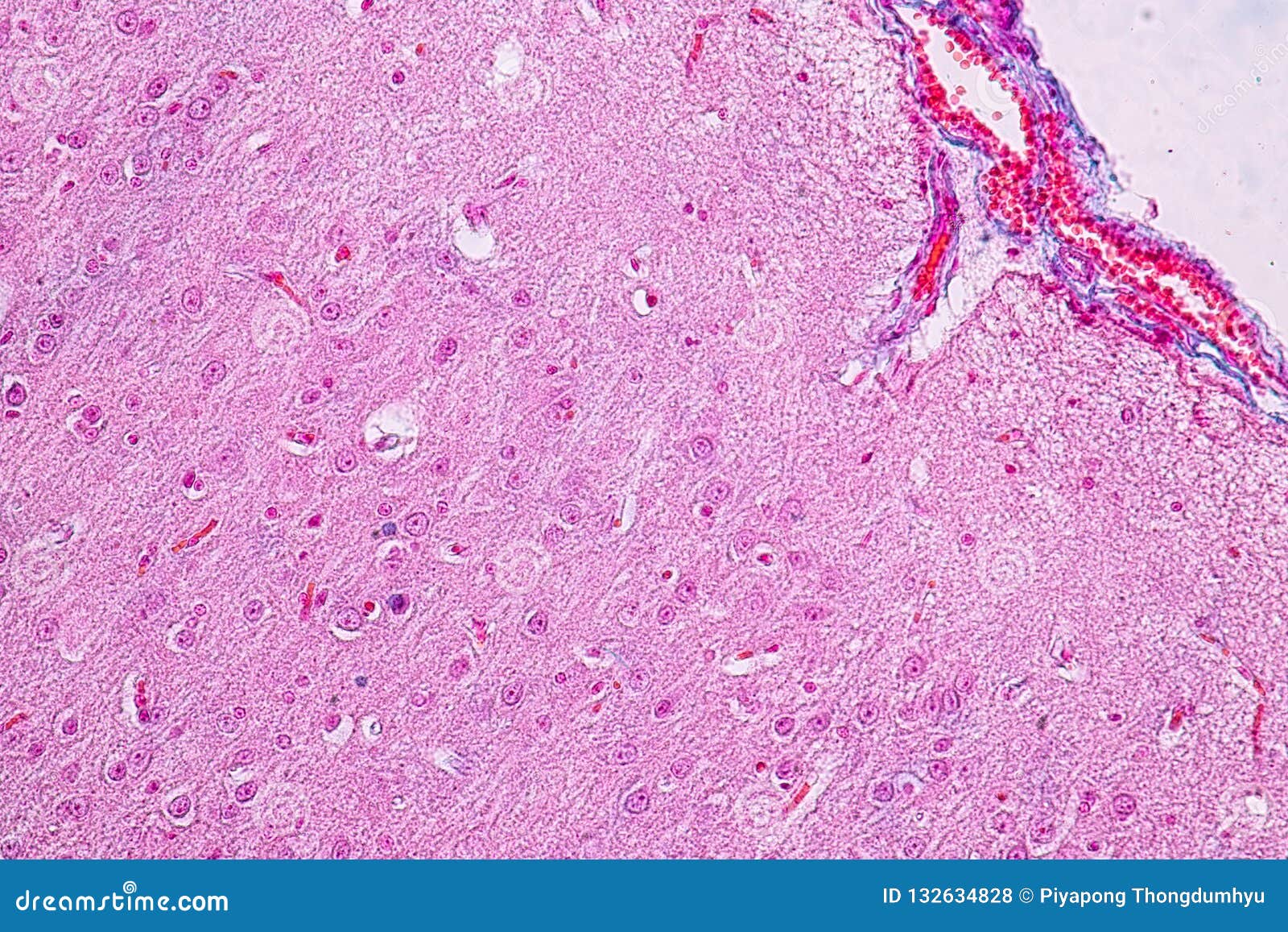 Cross Section of the Cerebellum and Nerve Human Under the Microscope ...