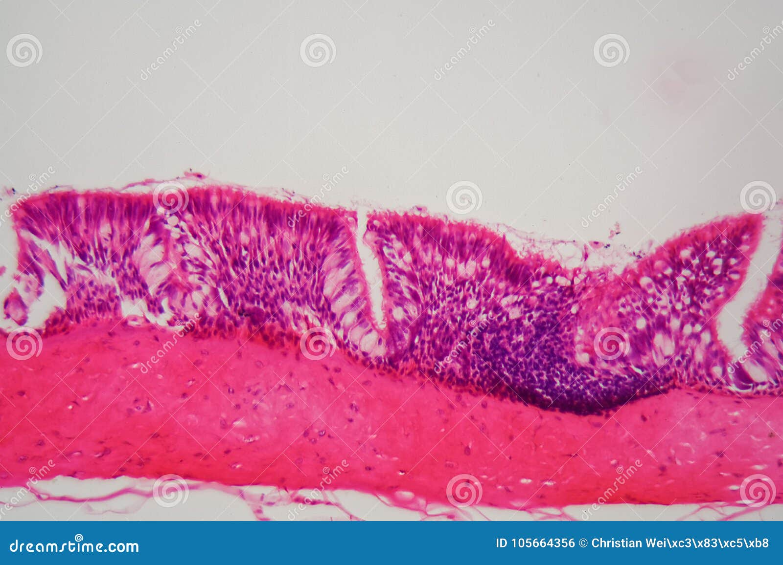 Trachea Cross Section