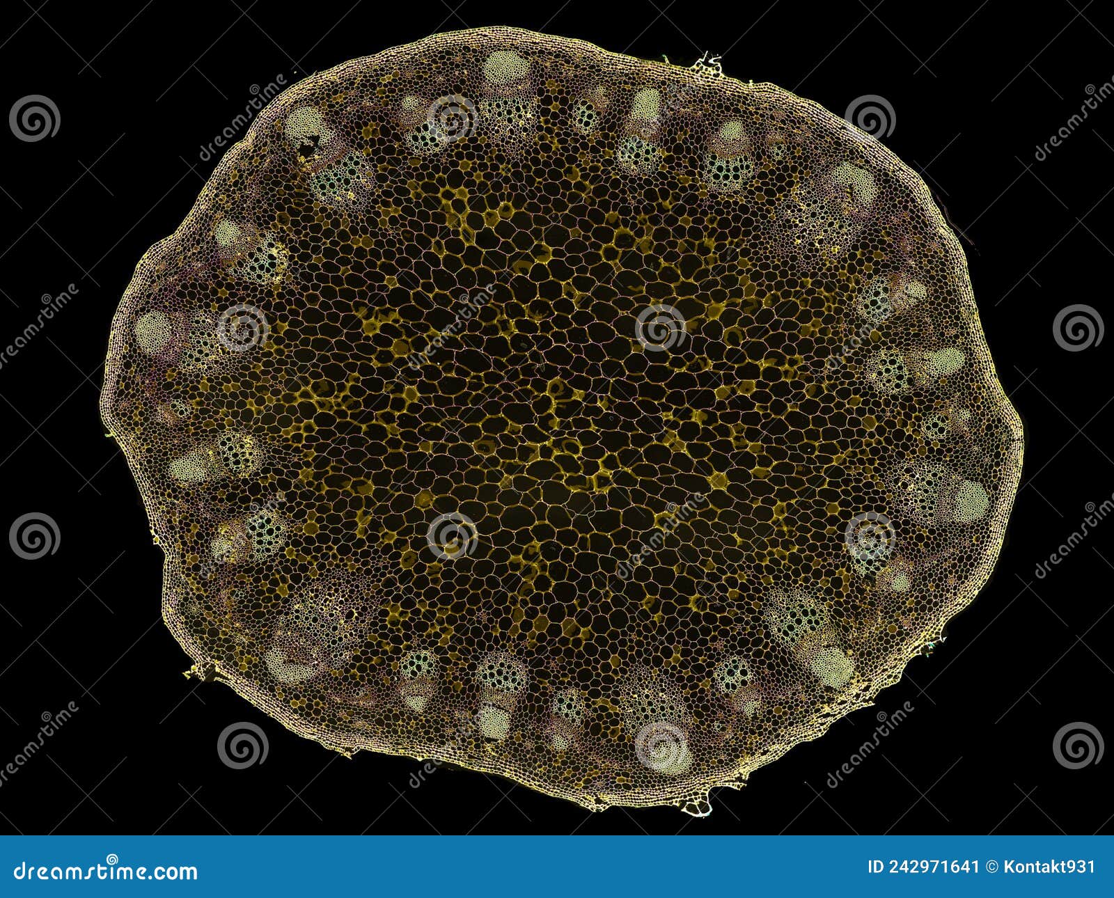 Cross Section Cut Slice of Plant Stem Under the Microscope â ...