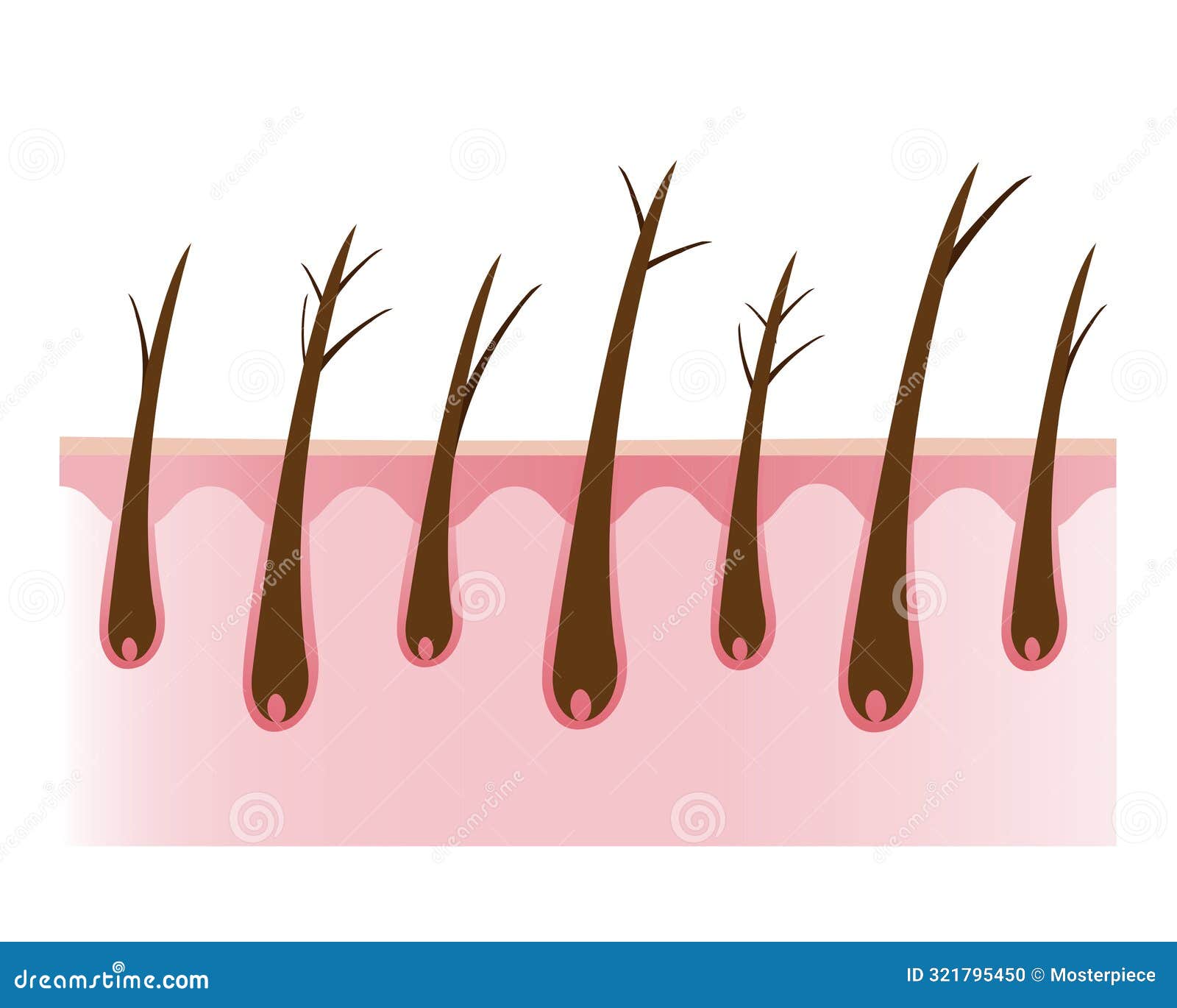 The Cross Section Of Damaged And Types Of Split Ends Hair With Scalp ...