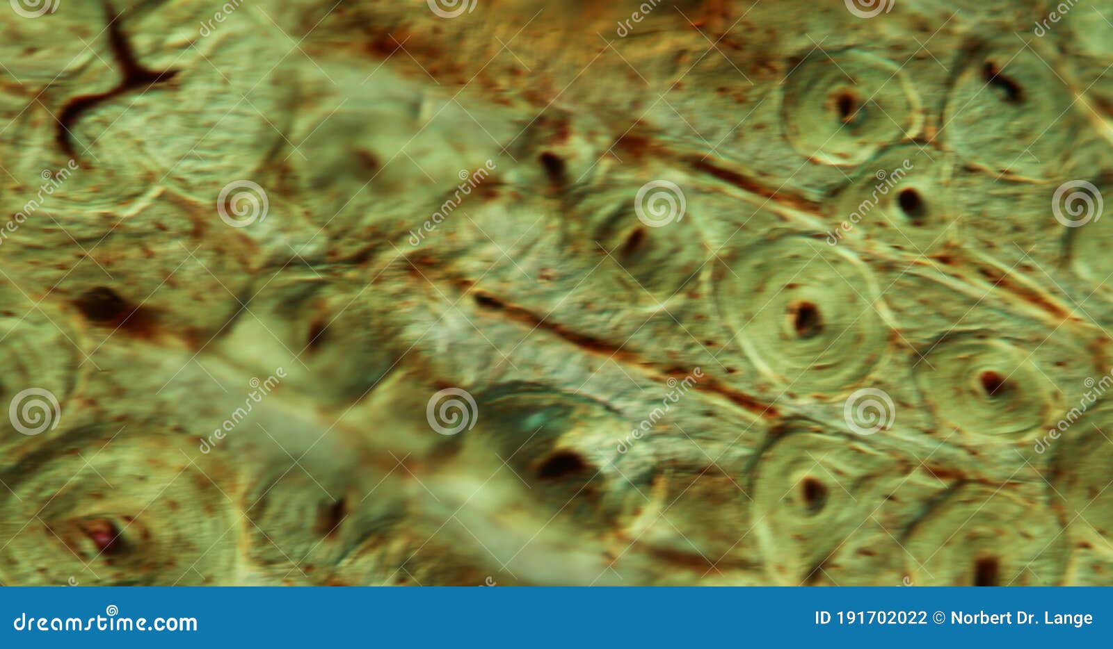 Cross-section of Decalcified Bone Stock Footage - Video of medic, check ...