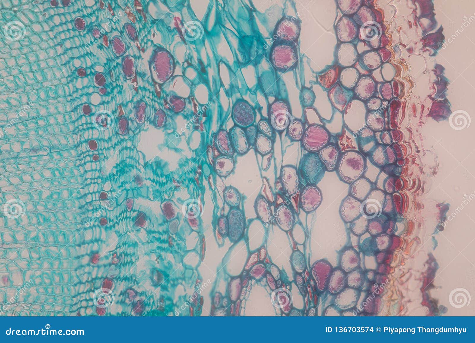Cross-section Dicot, Monocot and Root of Plant Stem Under the ...