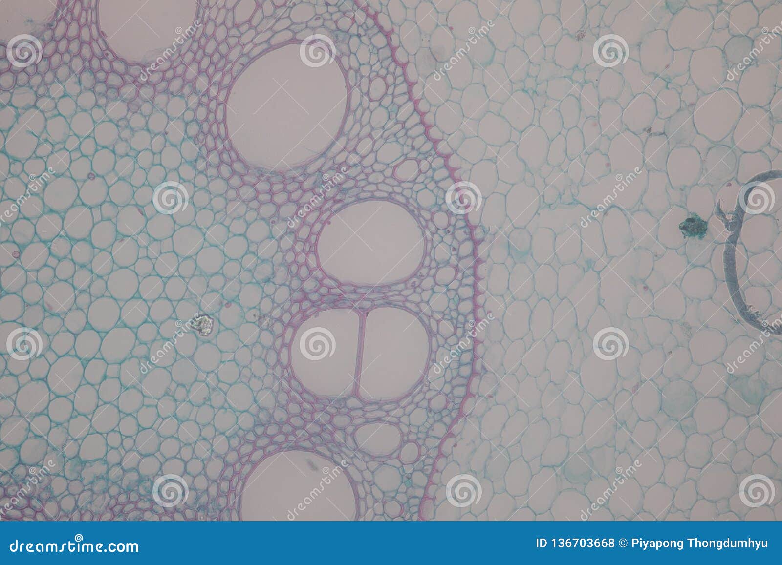 Dicot Root Cross Section Slide View Under Microscope For Botany ...