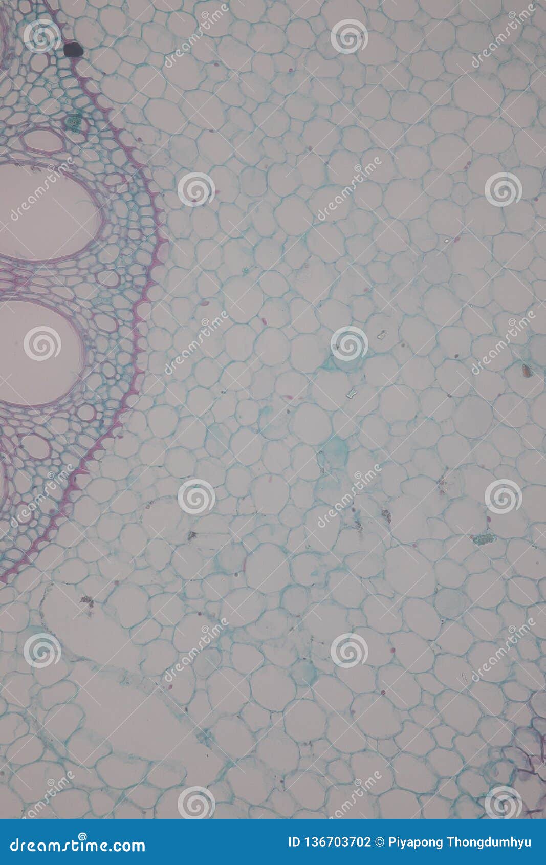 Cross-section Dicot, Monocot and Root of Plant Stem Under the ...