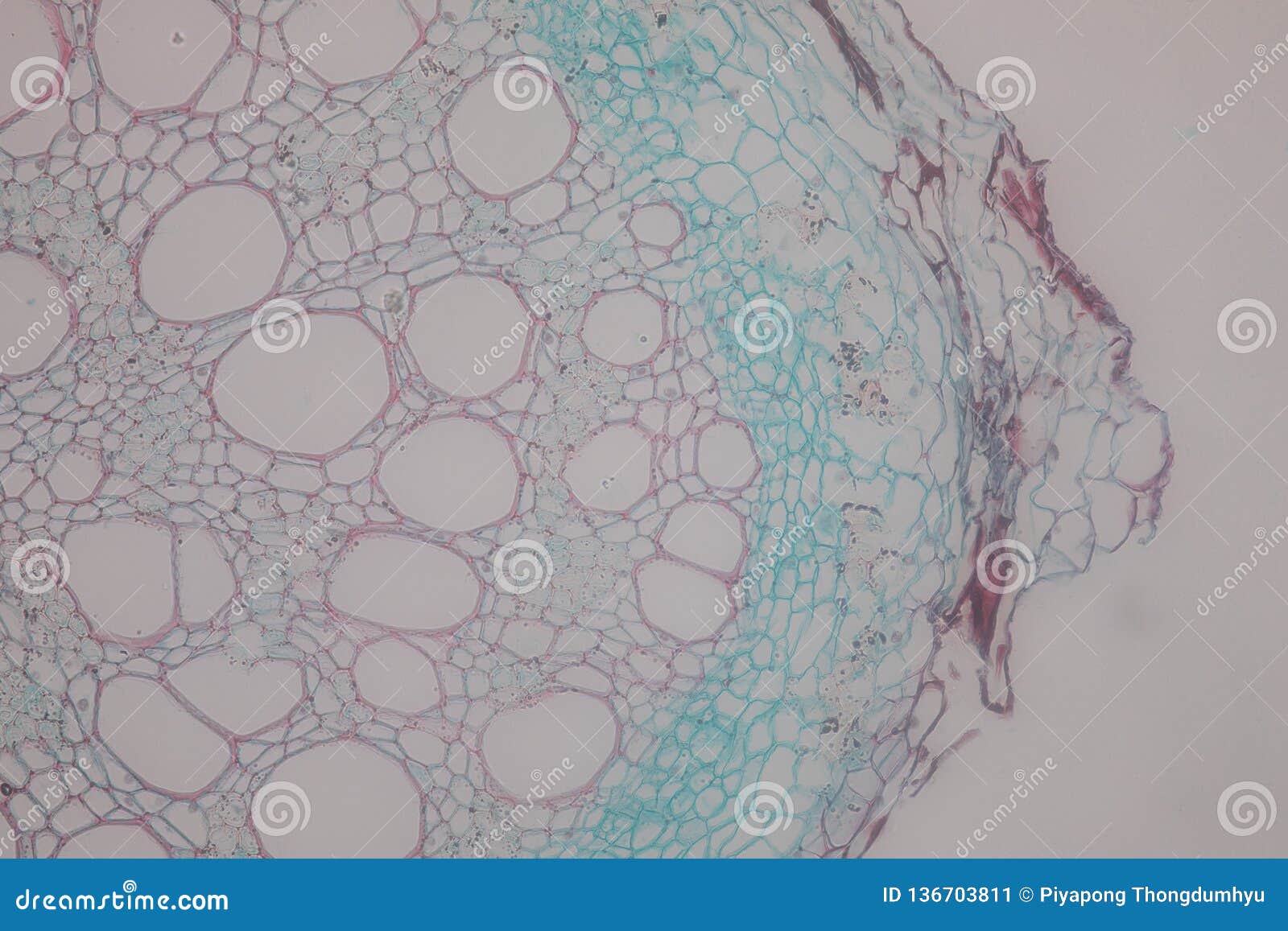 Cross-section Dicot, Monocot and Root of Plant Stem Under the ...