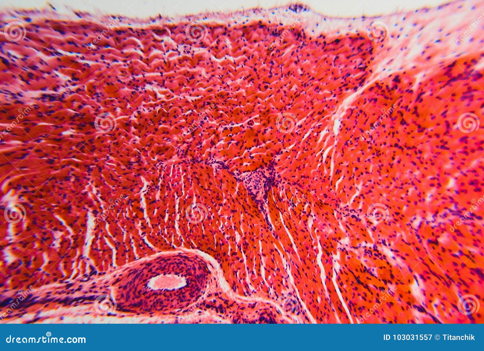 Cross Section Esophagus Dog Stock Image - Image of medical, disease ...
