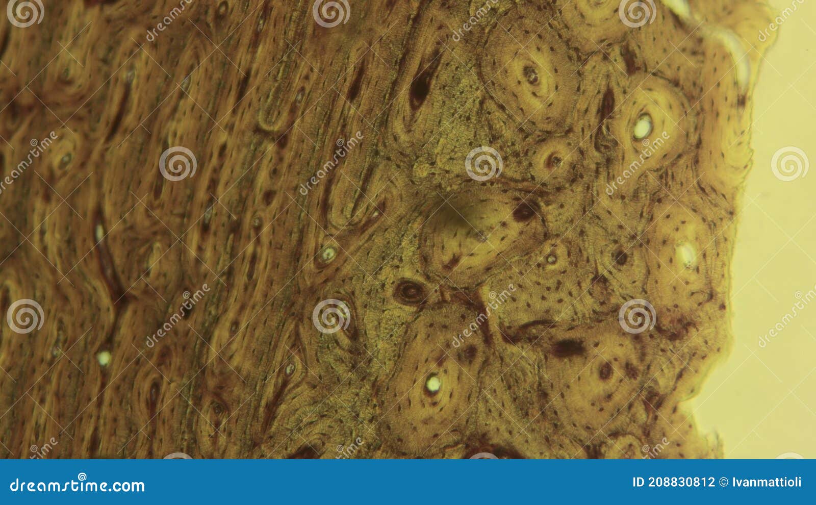 Bone Cells Under A Microscope