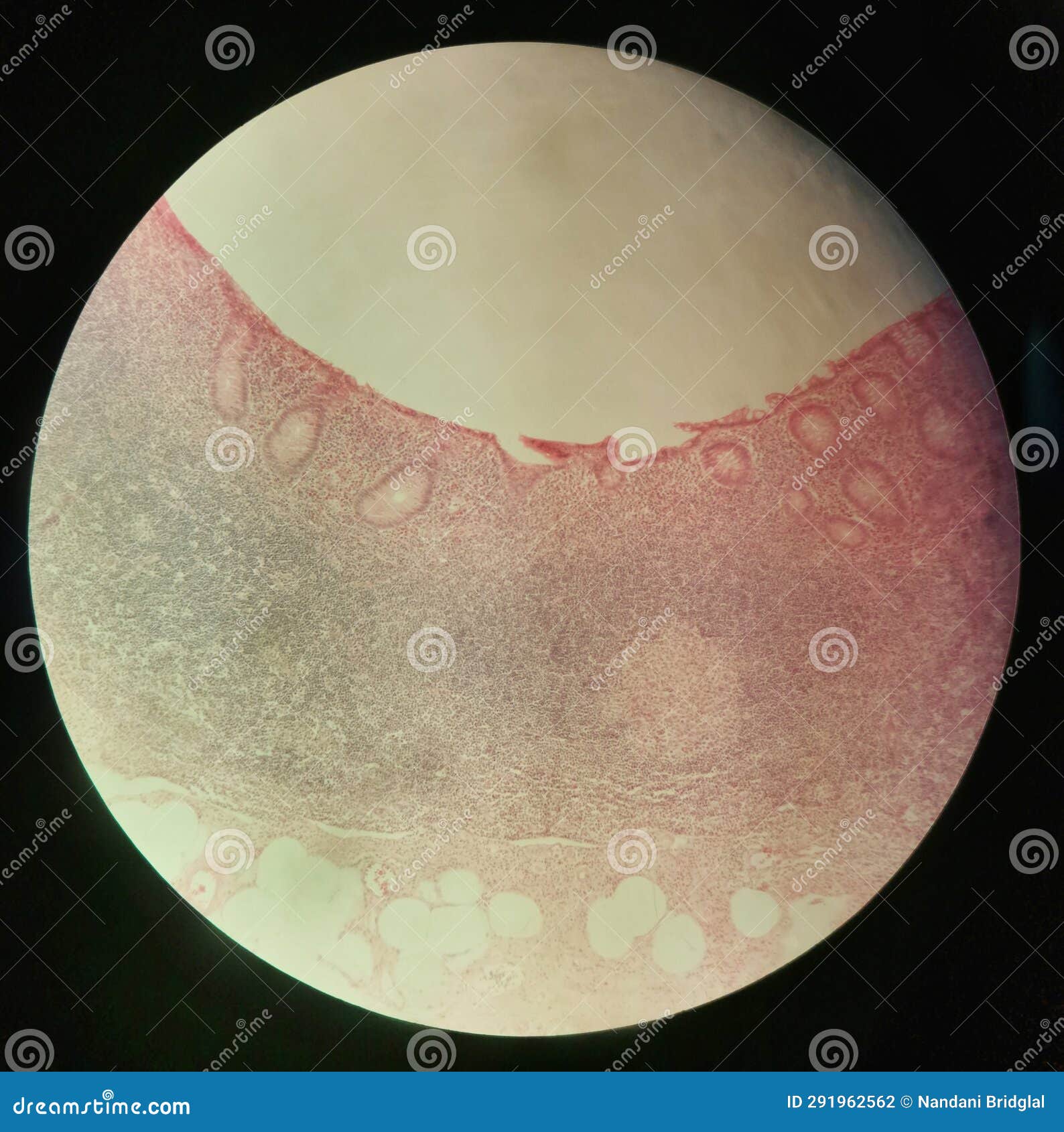 Cross Section through a Human Appendix Stock Photo - Image of body ...